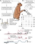 Spinal cord stimulation restores monkey’s ability to move paralysed ...