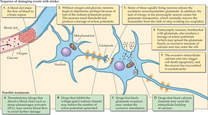 Preventing neuronal death: the future of stroke therapy – Speaking of ...