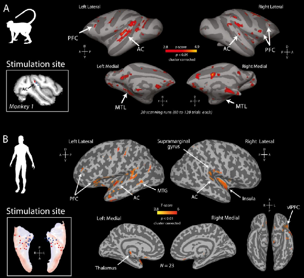 Shocking news? Why scientists stimulate the brain and the importance of ...