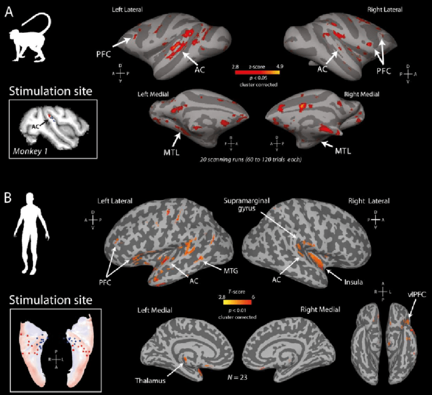 Shocking news? Why scientists stimulate the brain and the importance of ...